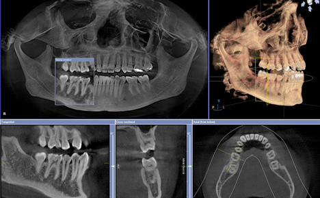 Mobile Dental Services – Mobile Dental Imaging MDI